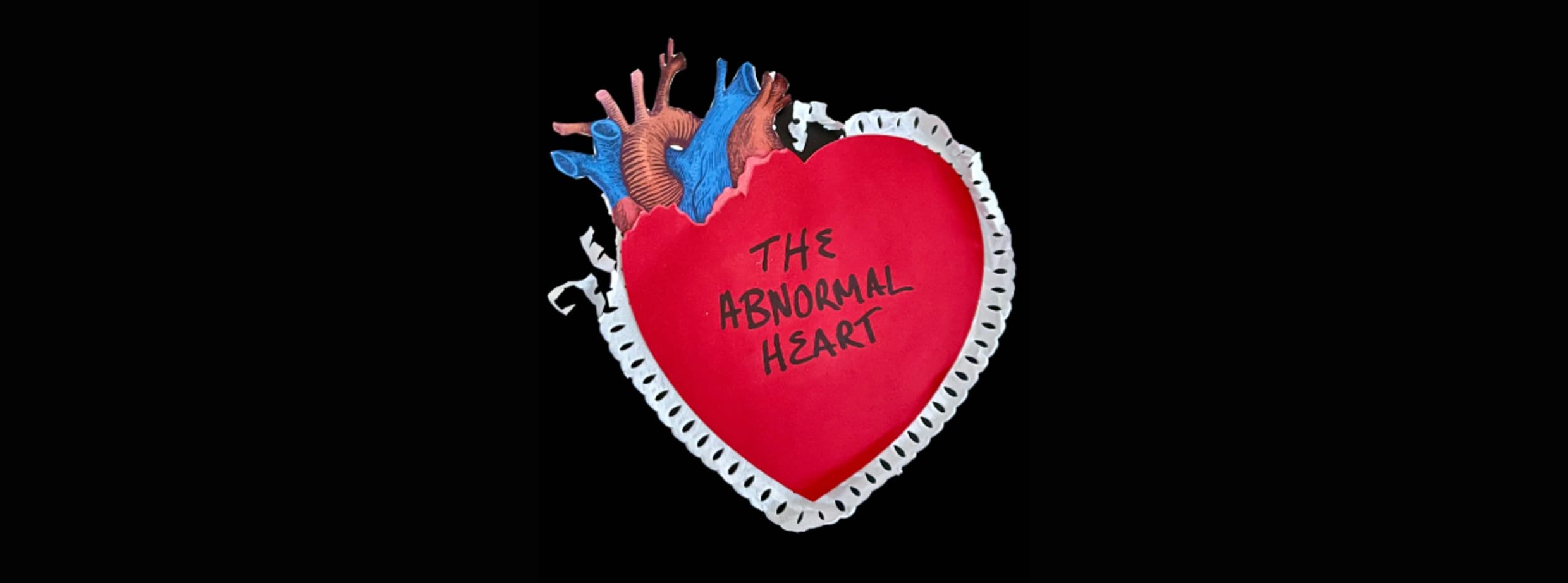 The Abnormal Heart — The Den Theatre