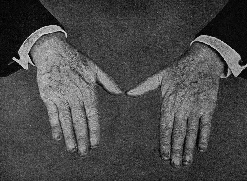 This Photo of Thomas Edison's Hands Was Clickbait in 1919 — Paleofuture
