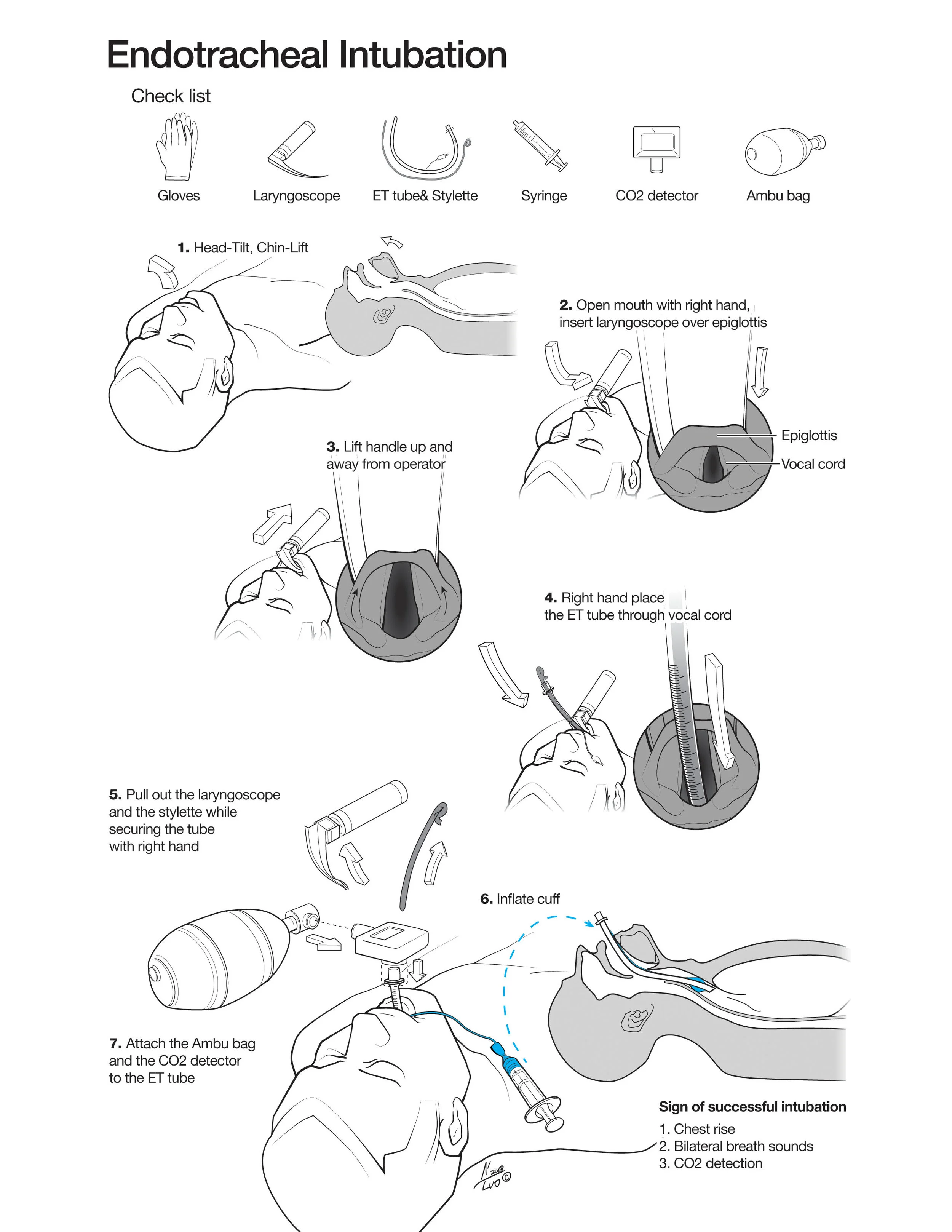 Illustration — Norman Luo
