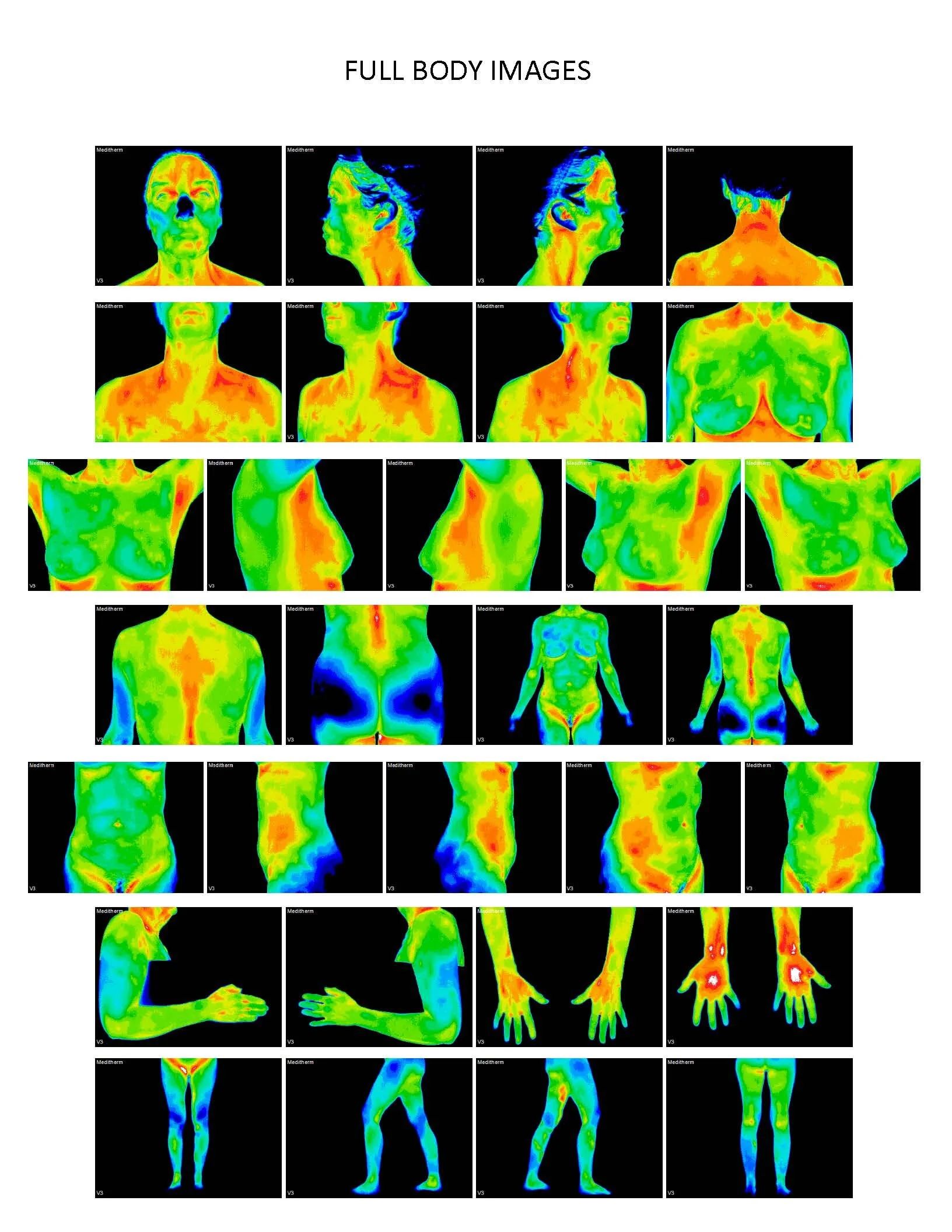 Thermography — Gratitude for Wellness