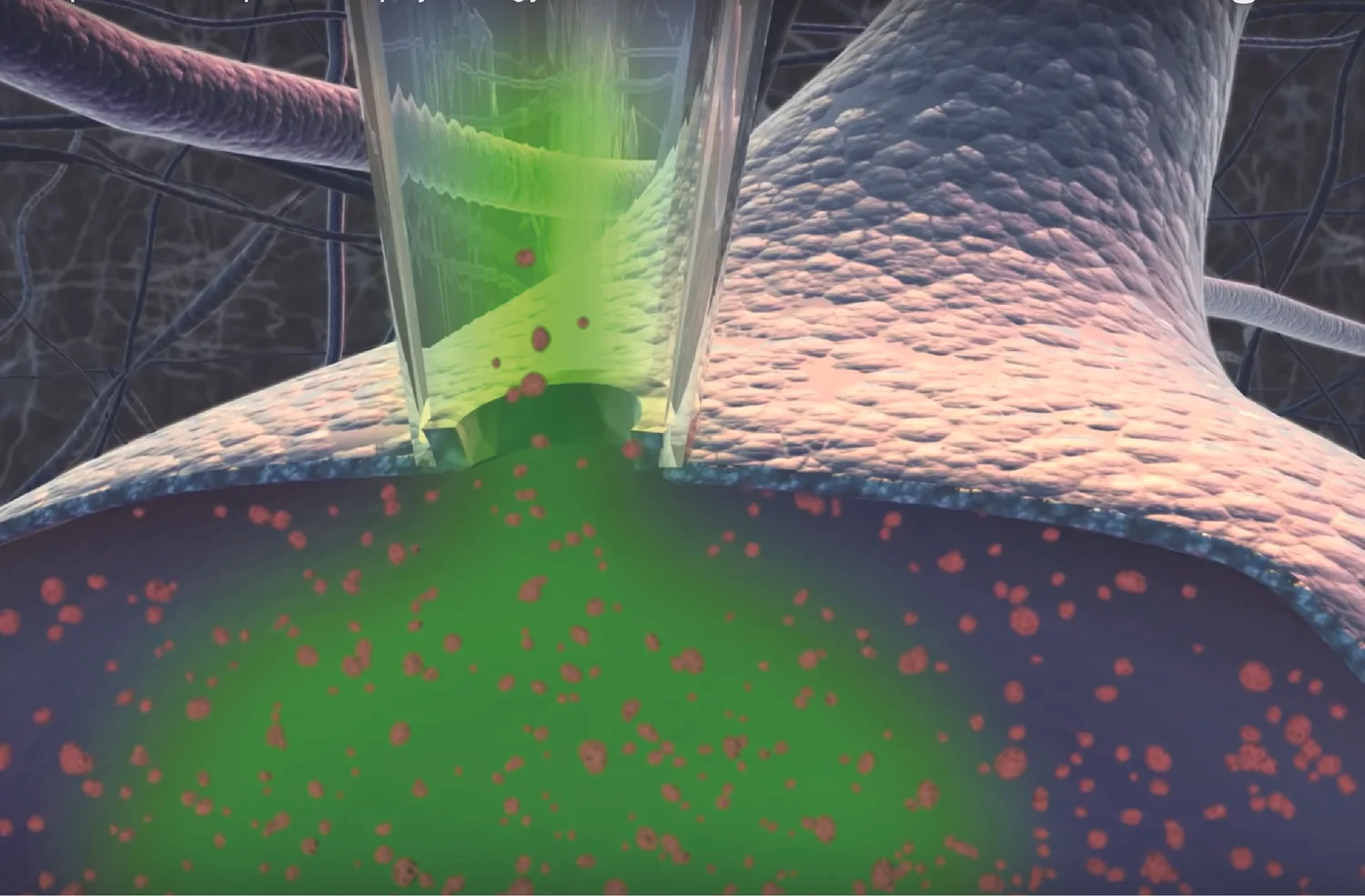 Robotics for single neural recordings — Biosensing and biorobotics ...