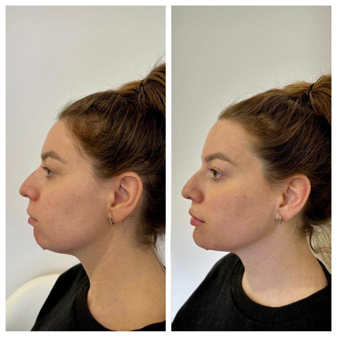 True Before and Afters (January 2024) | Skin and Sanctuary London