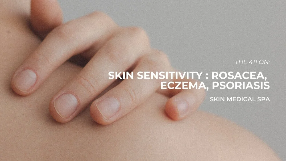 Skin Sensitivity: Rosacea, Eczema, Psoriasis, and Dermatitis — Skin ...