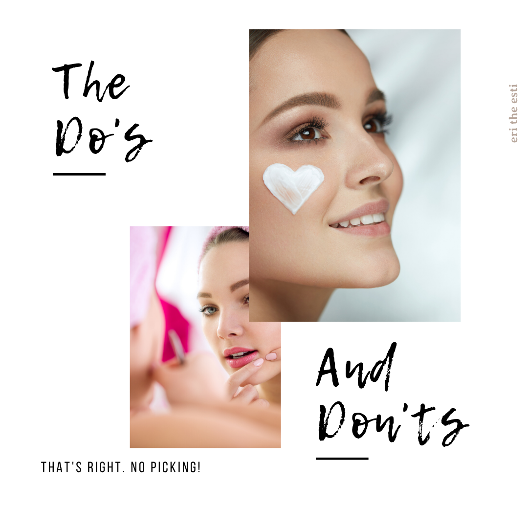 8 Steps to Treating a Pimple — Enlighten Bodhi