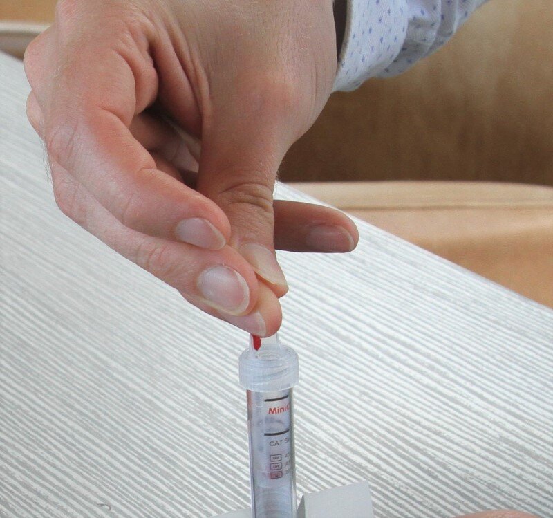 Bloedonderzoek - vitamine B12 tekort test — Health Stories