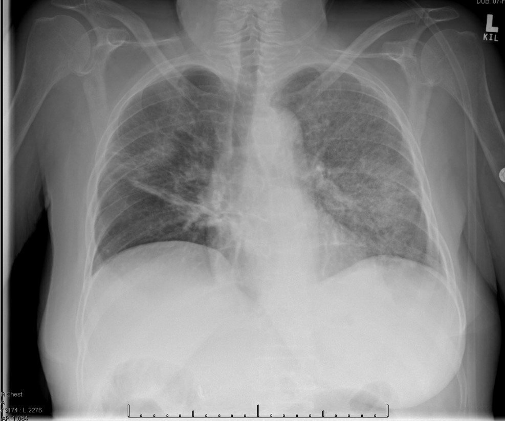 Interactive Case 10 — UBC IM POCUS
