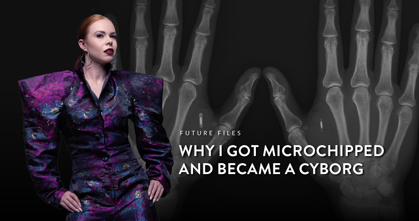I got my first microchip implant: Here’s why I did it — BRIAR PRESTIDGE