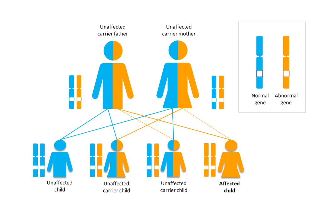 Leukodystrophy: early detection can help — Genepath