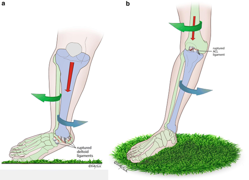 Blog | Set in Motion Physiotherapy