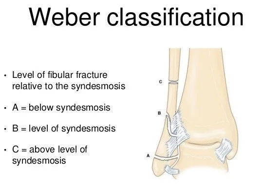Blog | Set in Motion Physiotherapy