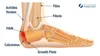 Blog | Set in Motion Physiotherapy