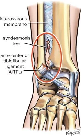 Blog | Set in Motion Physiotherapy