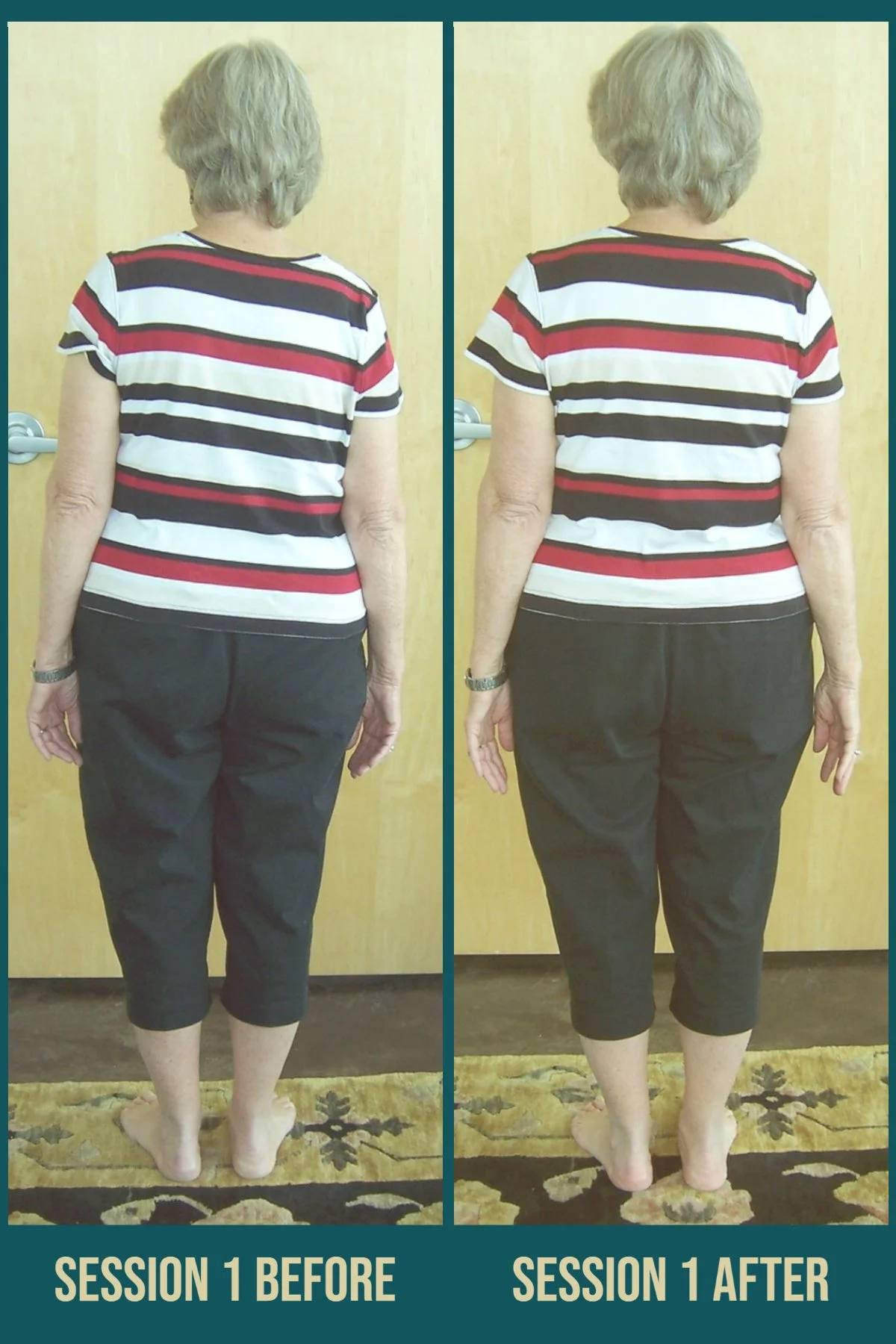 The Exercises — Symmetry Alignsmart