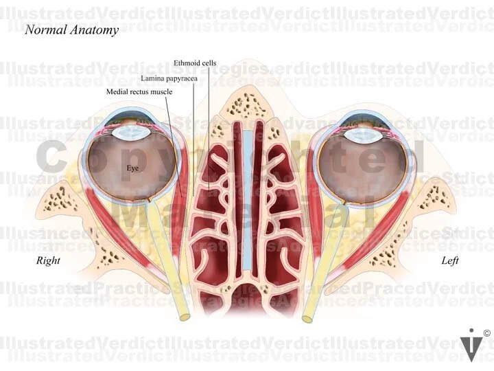 Stock Eye: Normal Anatomy — Illustrated Verdict