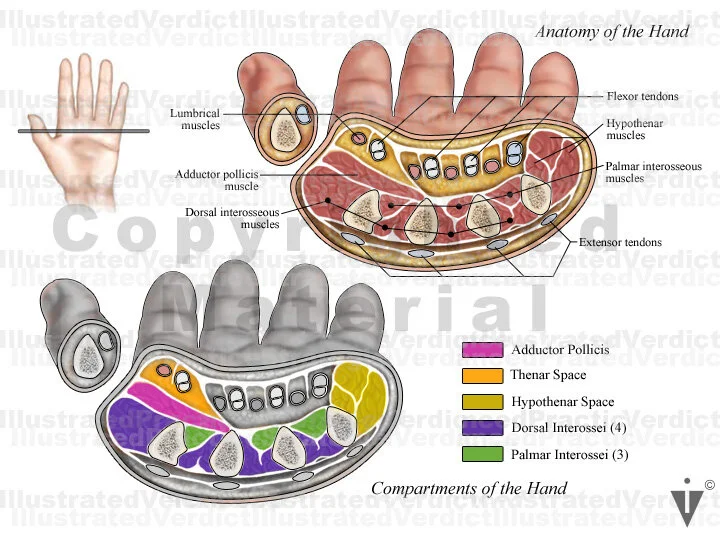 Stock Arm: Normal Anatomy — Illustrated Verdict