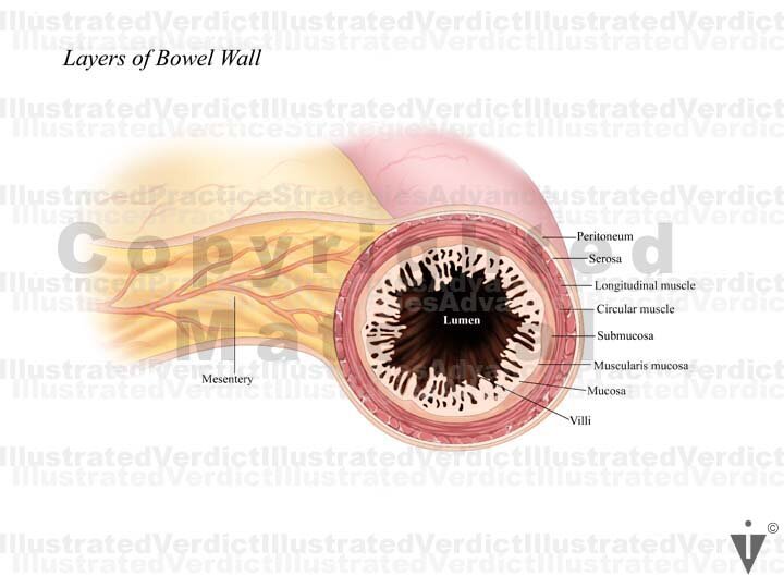 Stock Bowel: Normal Anatomy — Illustrated Verdict