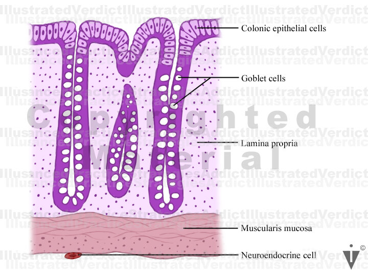 Stock Colon - Rectum: Normal Anatomy — Illustrated Verdict
