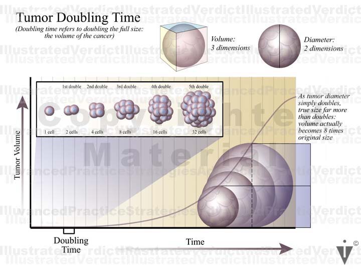 Stock Breast: Charts / Graphs — Illustrated Verdict