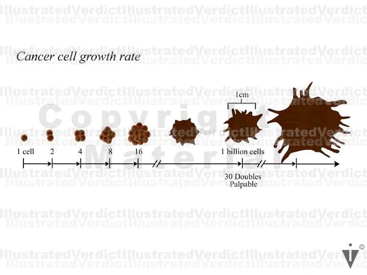Stock Breast: Charts / Graphs — Illustrated Verdict