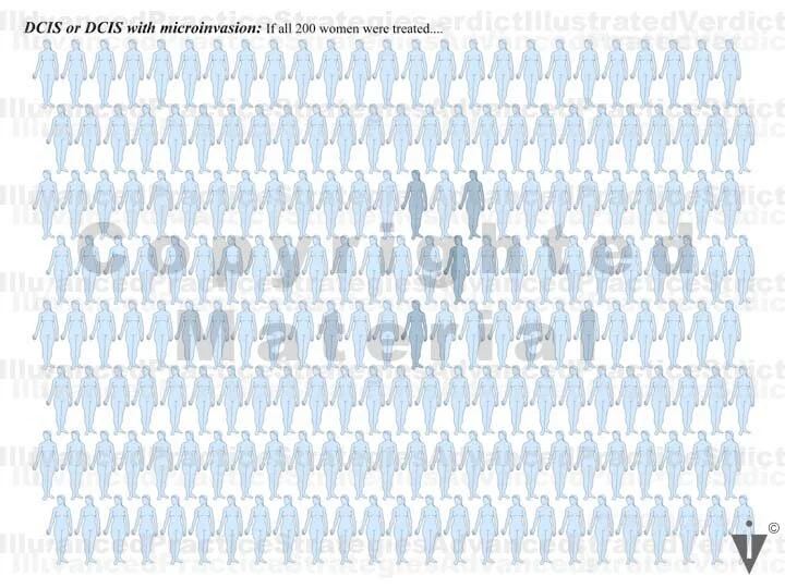 Stock Breast: Charts / Graphs — Illustrated Verdict