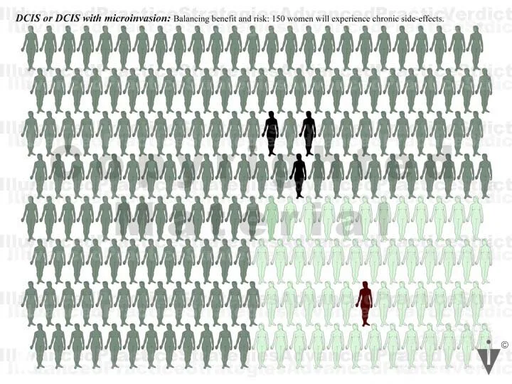 Stock Breast: Charts / Graphs — Illustrated Verdict