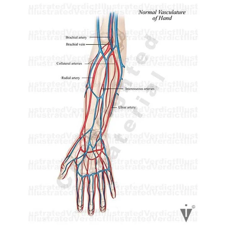 Stock IV: Placement / Complications — Illustrated Verdict
