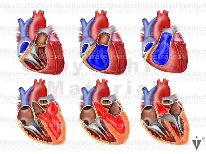 Stock Heart: Normal Anatomy — Illustrated Verdict