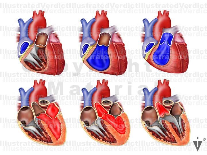 Stock Heart: Normal Anatomy — Illustrated Verdict