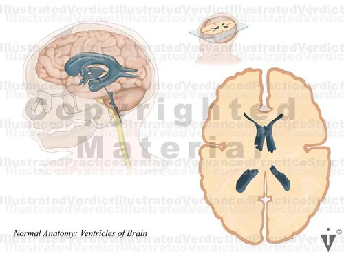Stock Baby: Brain Normal Anatomy — Illustrated Verdict