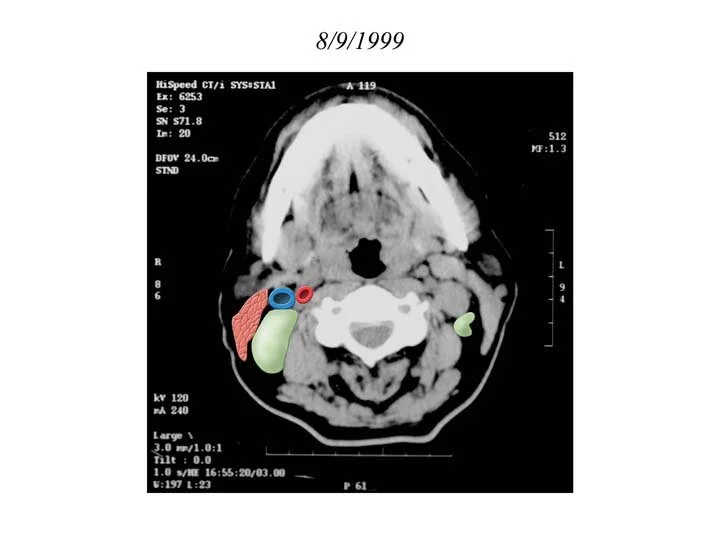 Stock Neck: Lymph Node Masses — Illustrated Verdict