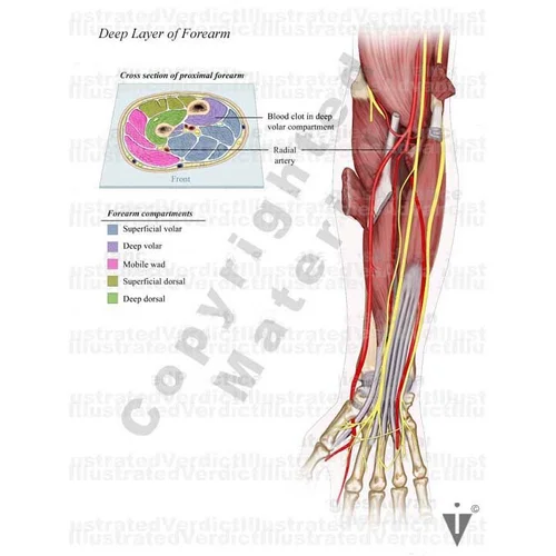Stock Arm: Normal Anatomy — Illustrated Verdict