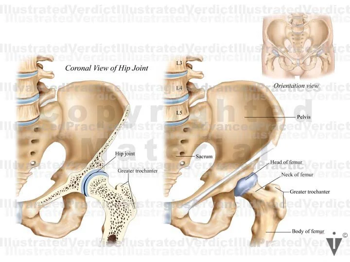 Stock Lower Limb: Orthopedic — Illustrated Verdict