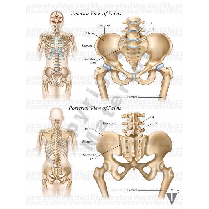 Stock Hip: Normal Anatomy — Illustrated Verdict