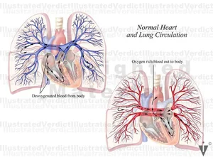 Stock Lungs: Normal Anatomy — Illustrated Verdict