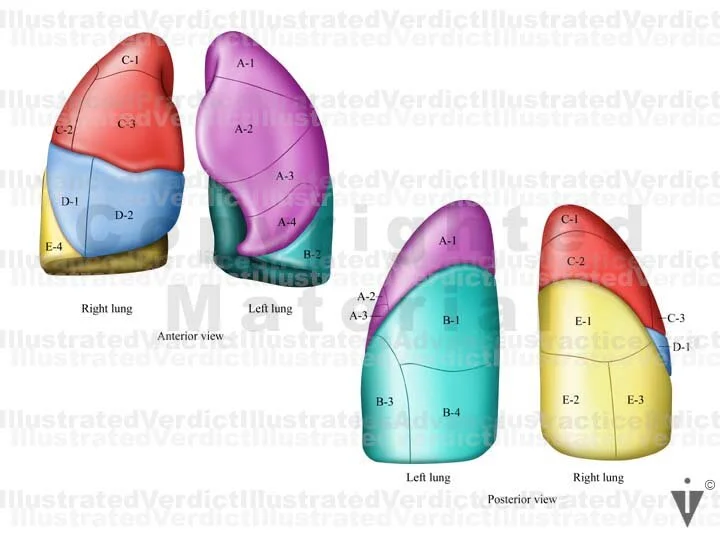 Stock Lungs: Normal Anatomy — Illustrated Verdict