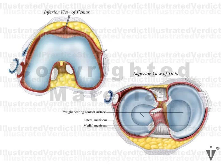 Stock Knee: Normal Anatomy — Illustrated Verdict