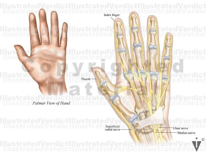 Stock Upper Limb: Hand — Illustrated Verdict