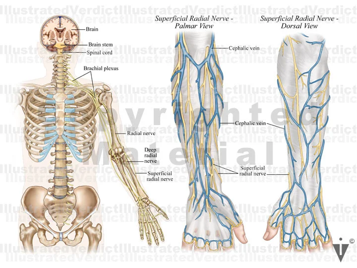 Stock Upper Limb: Arm Vasculature — Illustrated Verdict