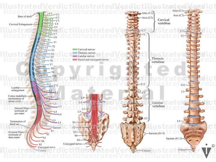 Template Spine: Spine Cord Stimulator — Illustrated Verdict