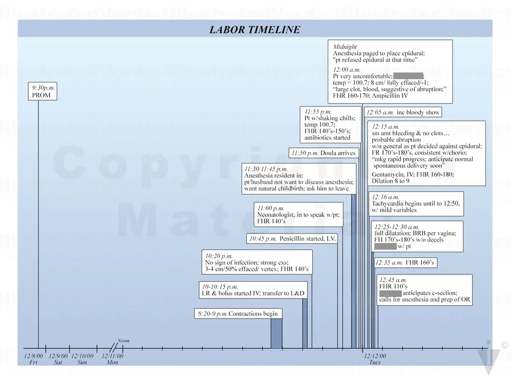Stock Timelines / Charts: Example Timelines — Illustrated Verdict