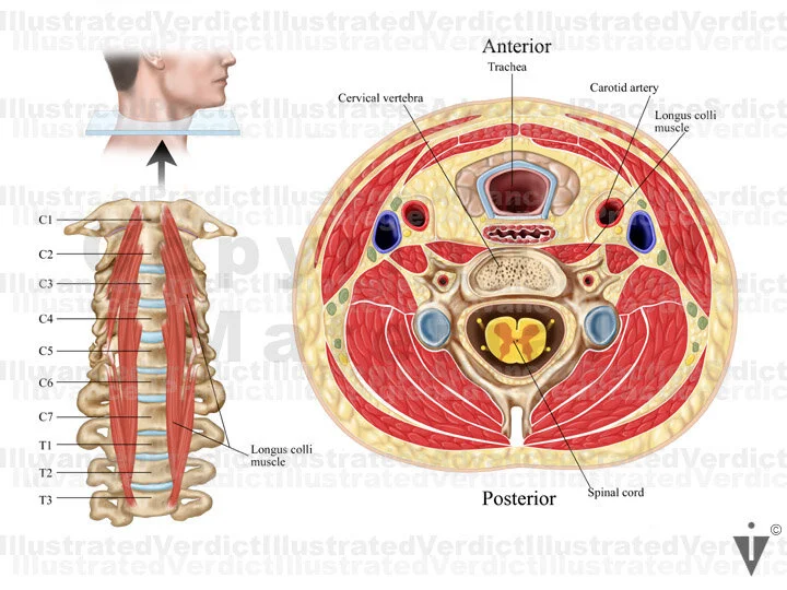 Back Muscle Anatomy Cross Section at Monte Stock blog