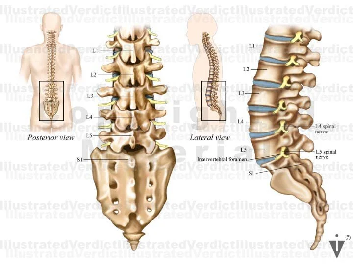 Stock Spine: Lumbar and Sacral Spine — Illustrated Verdict