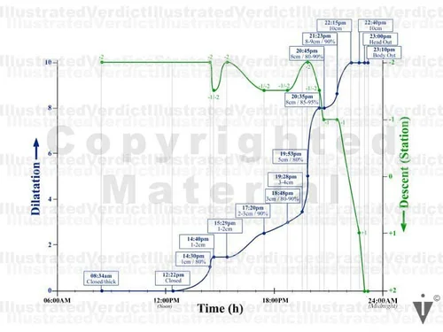 Stock Pregnancy / Delivery: Charts / Graphs / Labor Curves ...