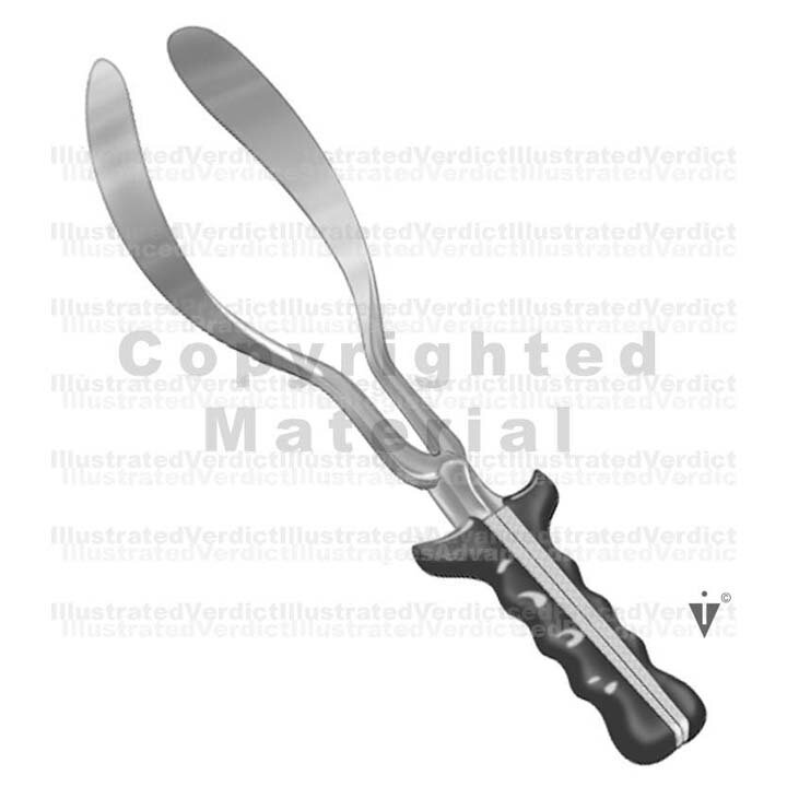 Stock Pregnancy / Delivery: Vacuum / Forceps — Illustrated Verdict