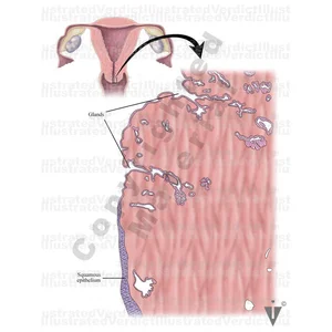Stock Female Pelvis: Cervix — Illustrated Verdict