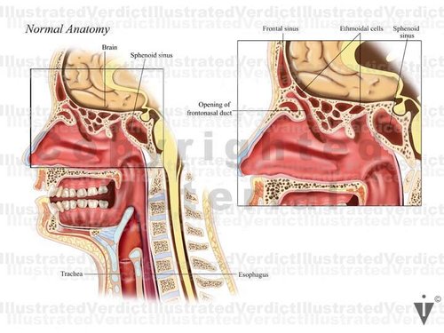 Stock Nose / Sinus: Normal Anatomy — Illustrated Verdict