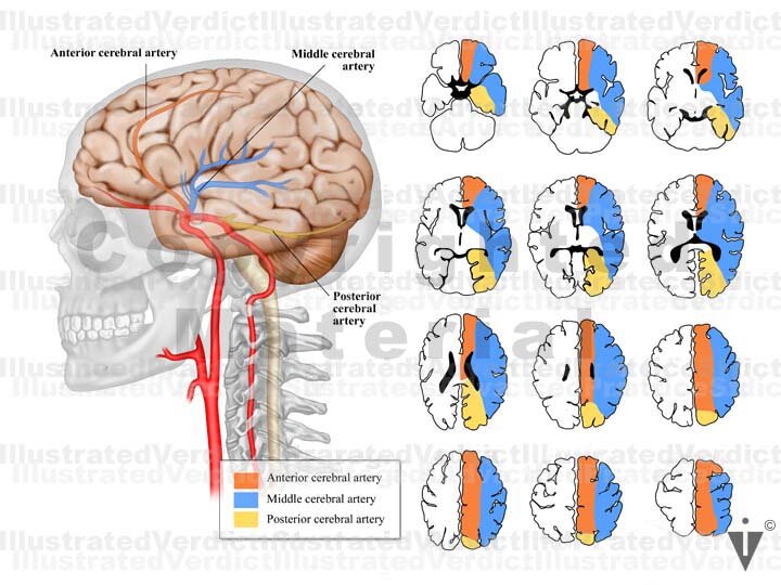 Stock Brain: Normal Anatomy Vasculature — Illustrated Verdict