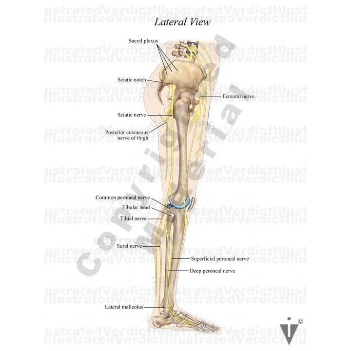 Stock Female Pelvis: Nerves — Illustrated Verdict