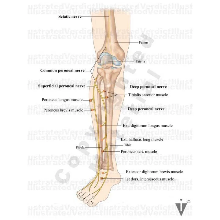 Stock Female Pelvis: Nerves — Illustrated Verdict