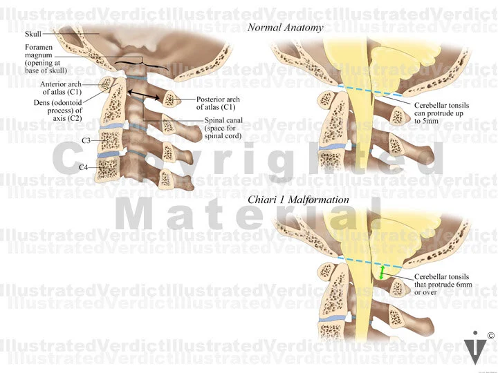 Stock Template Brain: Malformations — Illustrated Verdict